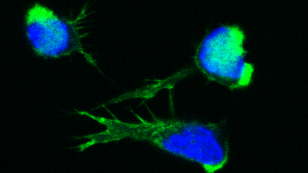 How Cell Skeleton Defects Can Teach Immunology