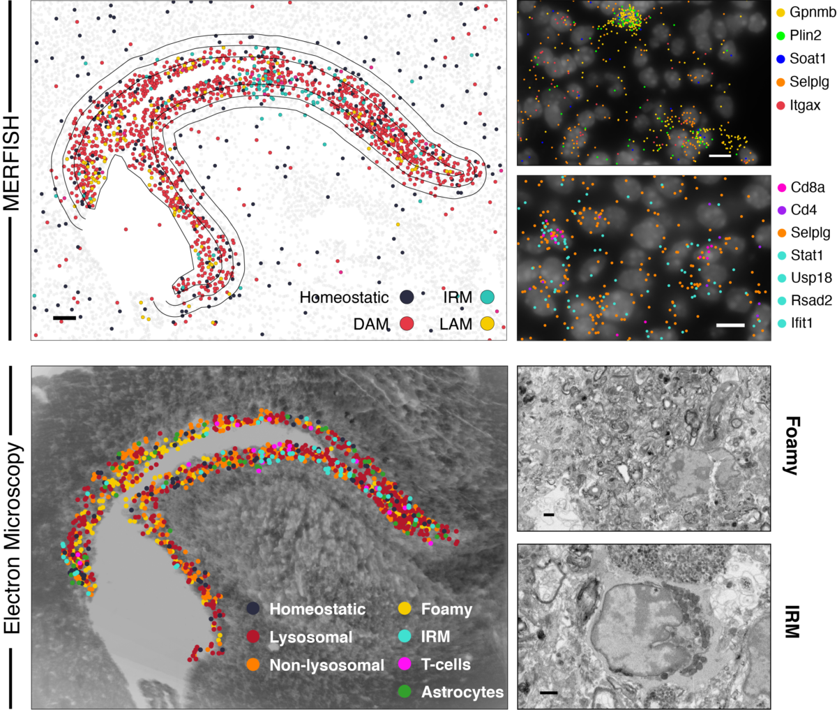 Spatial Transcriptomics-correlated Electron Microscopy